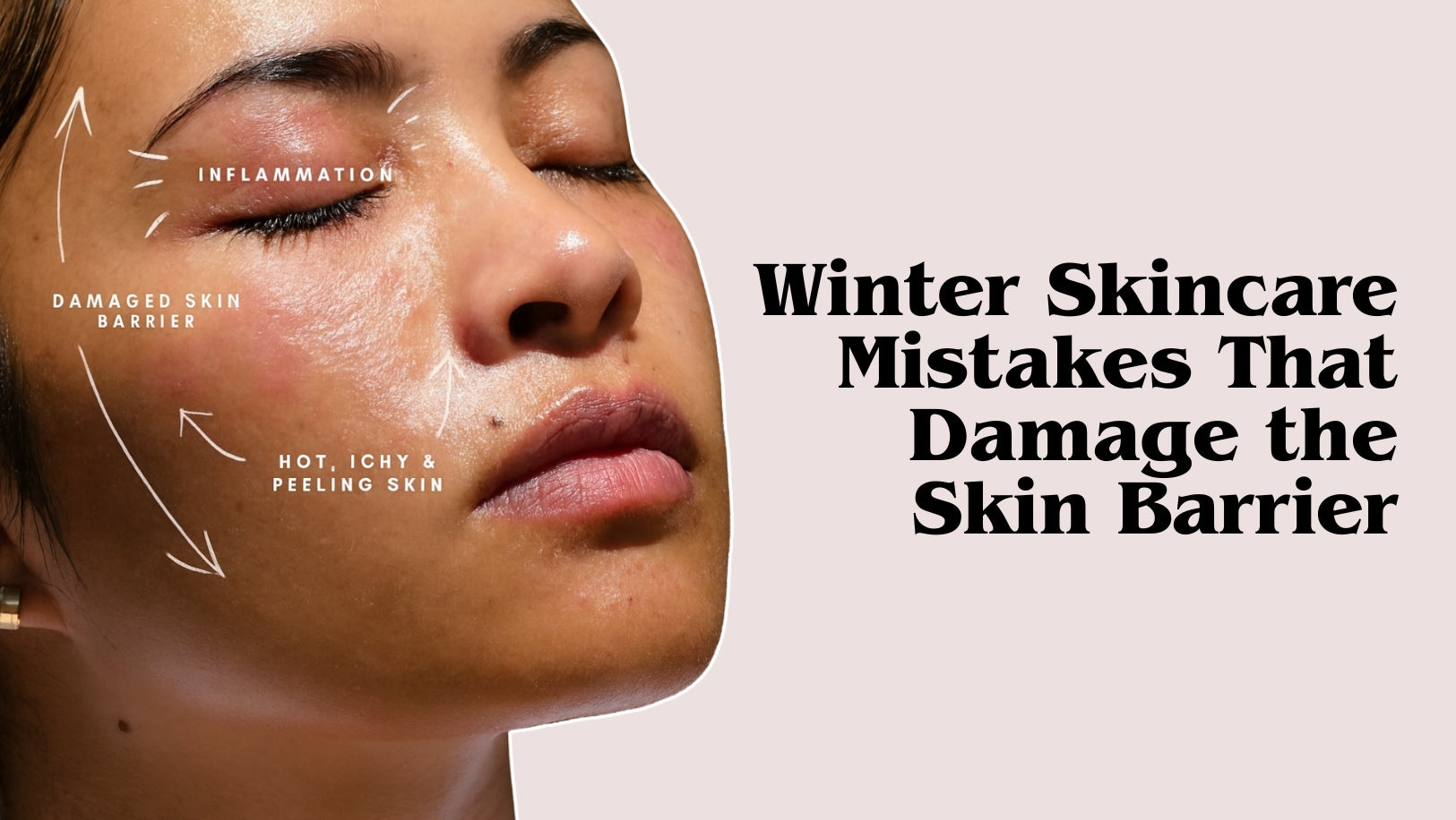5 Winter Skincare Mistakes That Damage Your Skin Barrier – Perenne ...