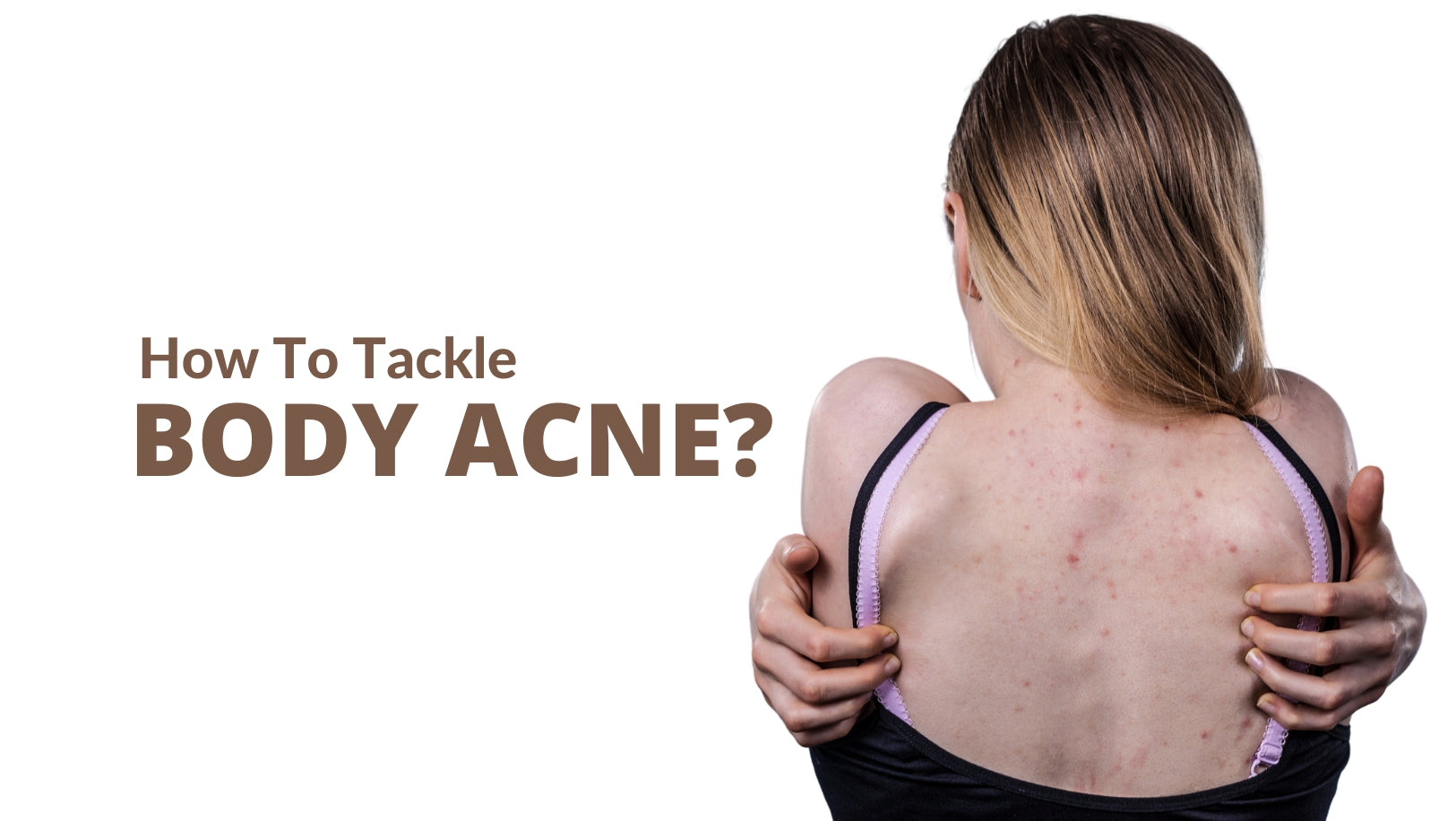 How to Tackle Body Acne? – Perenne Cosmetics